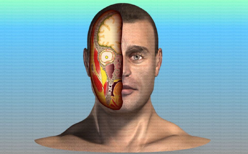 achievements - Lengthening Temporalis Myoplasty (MAT